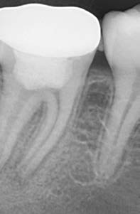 Journal of Clinical Pediatric Dentistry (JOCPD)