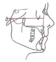 Journal of Clinical Pediatric Dentistry (JOCPD)