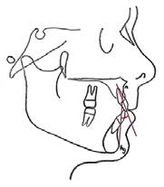 Journal of Clinical Pediatric Dentistry (JOCPD)
