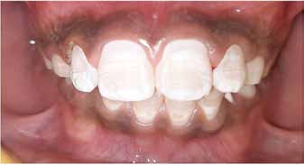 Journal of Clinical Pediatric Dentistry (JOCPD)