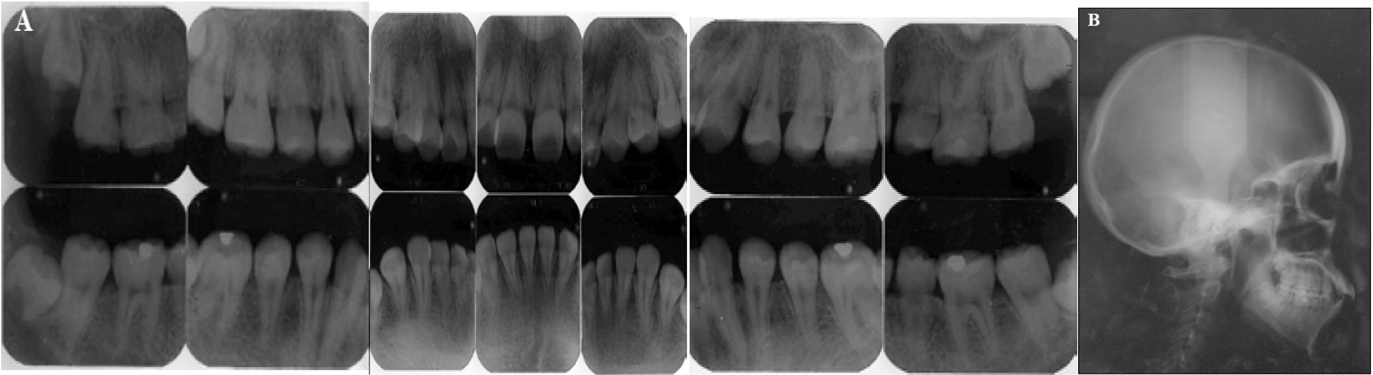 Journal of Clinical Pediatric Dentistry (JOCPD)