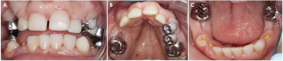 Journal of Clinical Pediatric Dentistry (JOCPD)