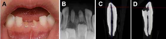 Journal of Clinical Pediatric Dentistry (JOCPD)