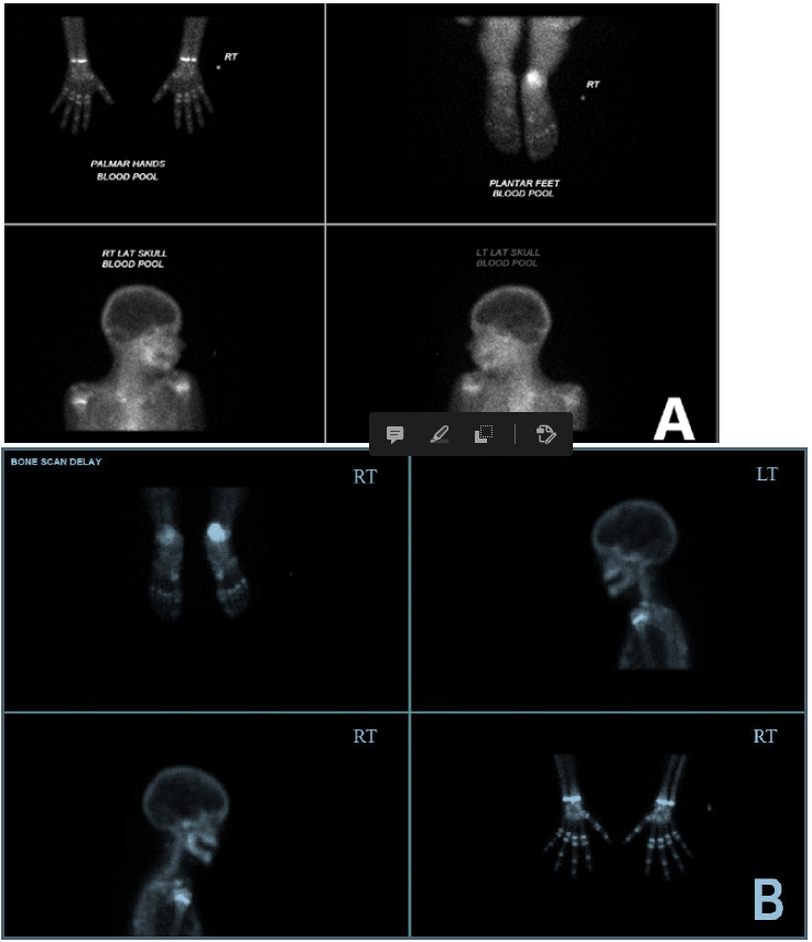 Journal of Clinical Pediatric Dentistry (JOCPD)