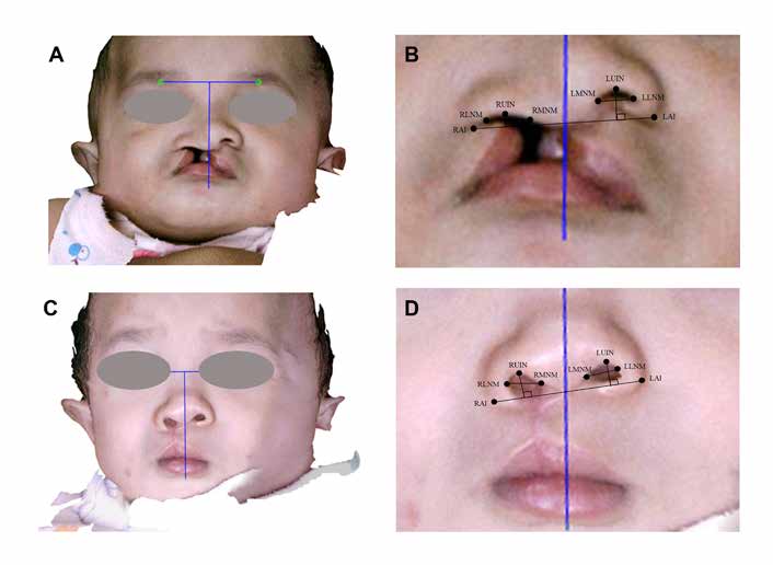 Journal of Clinical Pediatric Dentistry (JOCPD)