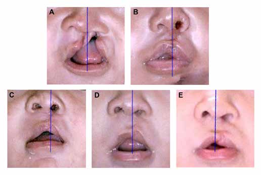Journal of Clinical Pediatric Dentistry (JOCPD)
