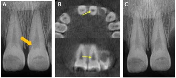 Journal of Clinical Pediatric Dentistry (JOCPD)