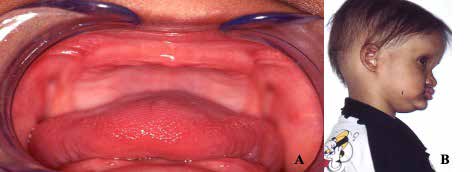 Journal of Clinical Pediatric Dentistry (JOCPD)