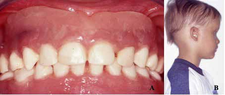 Journal of Clinical Pediatric Dentistry (JOCPD)