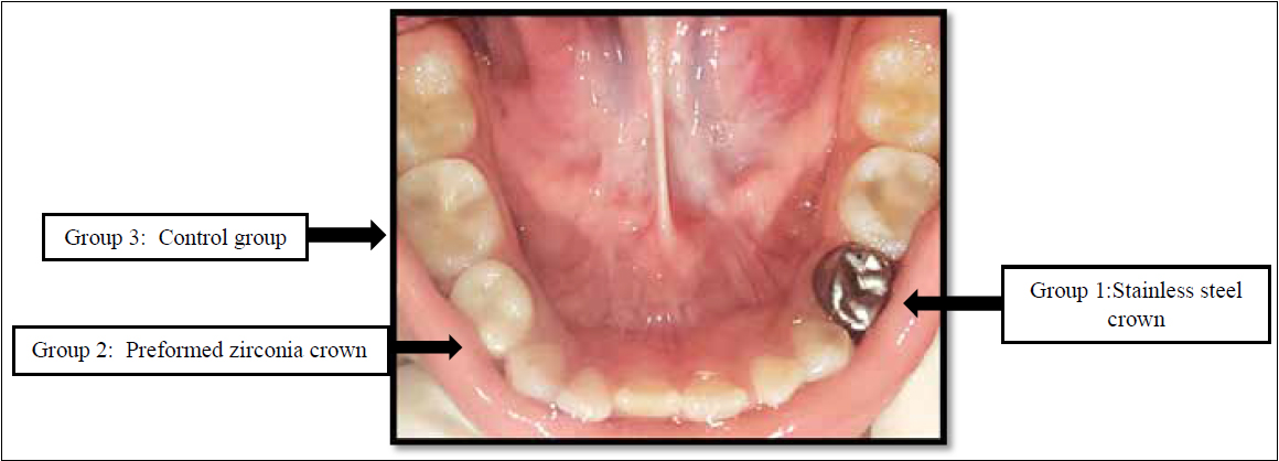 Journal of Clinical Pediatric Dentistry (JOCPD)