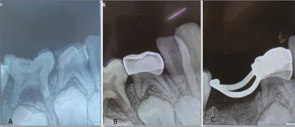 Journal of Clinical Pediatric Dentistry (JOCPD)