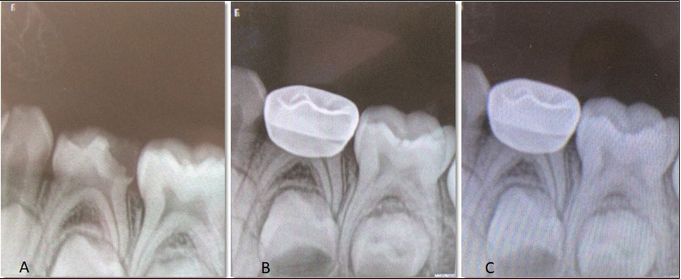 Journal of Clinical Pediatric Dentistry (JOCPD)
