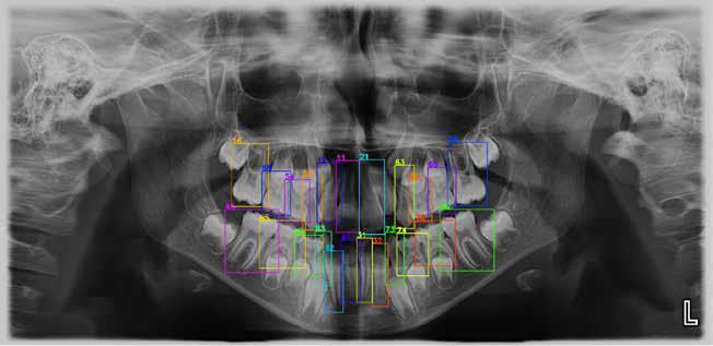 Journal of Clinical Pediatric Dentistry (JOCPD)