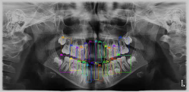 Journal of Clinical Pediatric Dentistry (JOCPD)