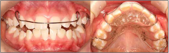 Journal of Clinical Pediatric Dentistry (JOCPD)