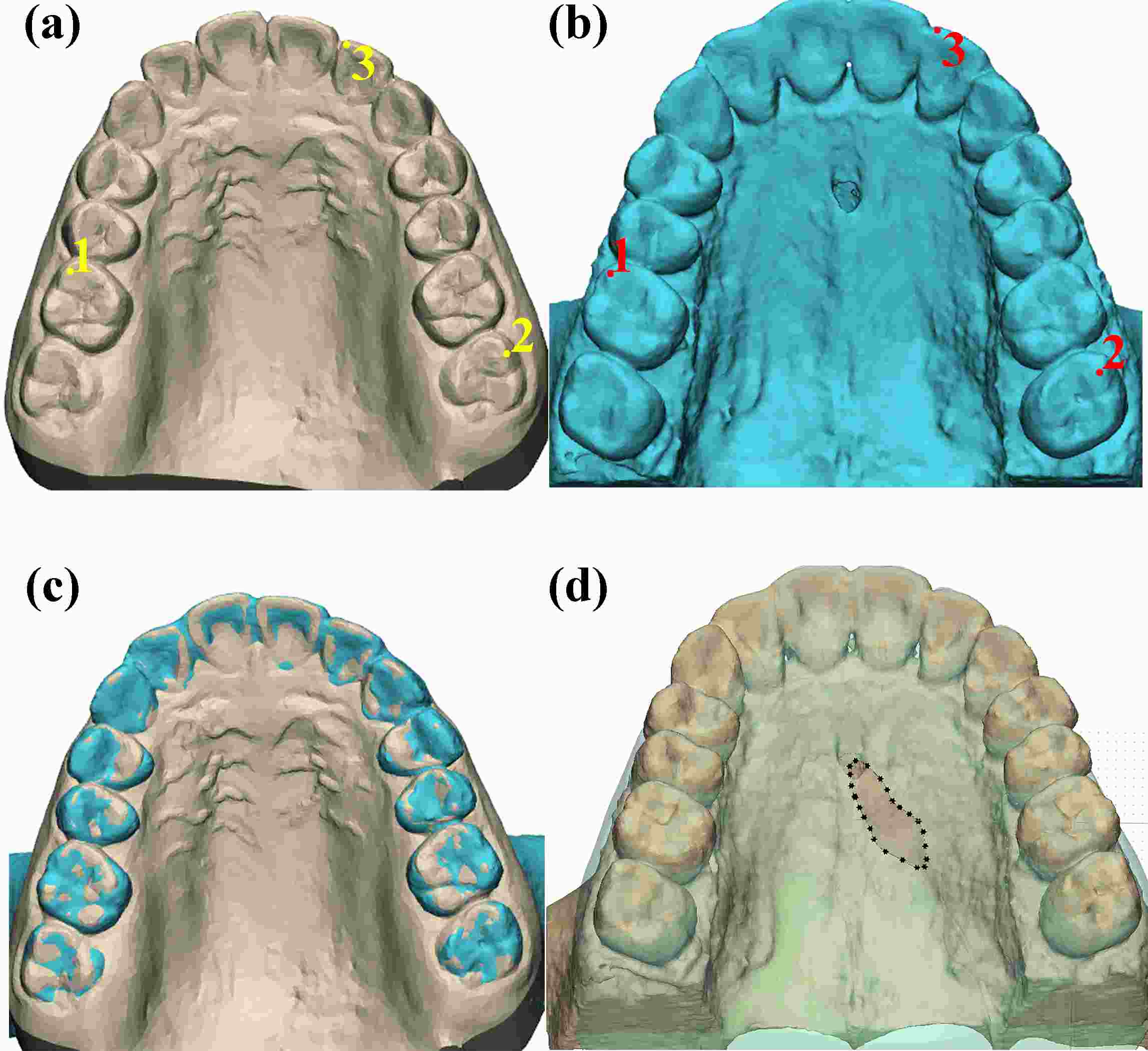 Journal of Clinical Pediatric Dentistry (JOCPD)