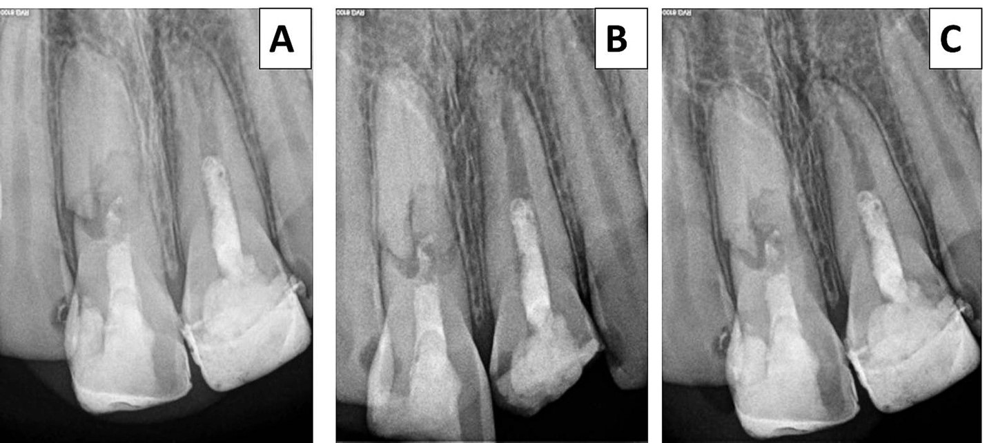 Journal of Clinical Pediatric Dentistry (JOCPD)