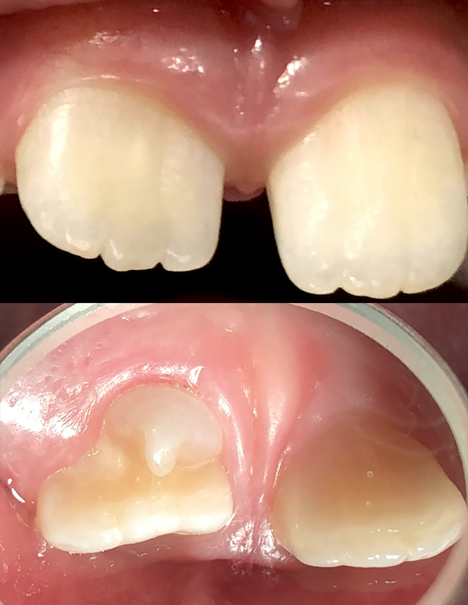 Journal of Clinical Pediatric Dentistry (JOCPD)