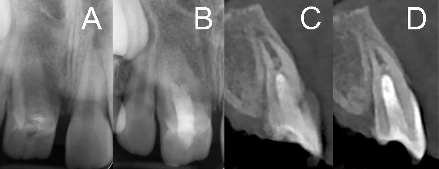 Journal of Clinical Pediatric Dentistry (JOCPD)