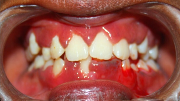 Journal of Clinical Pediatric Dentistry (JOCPD)