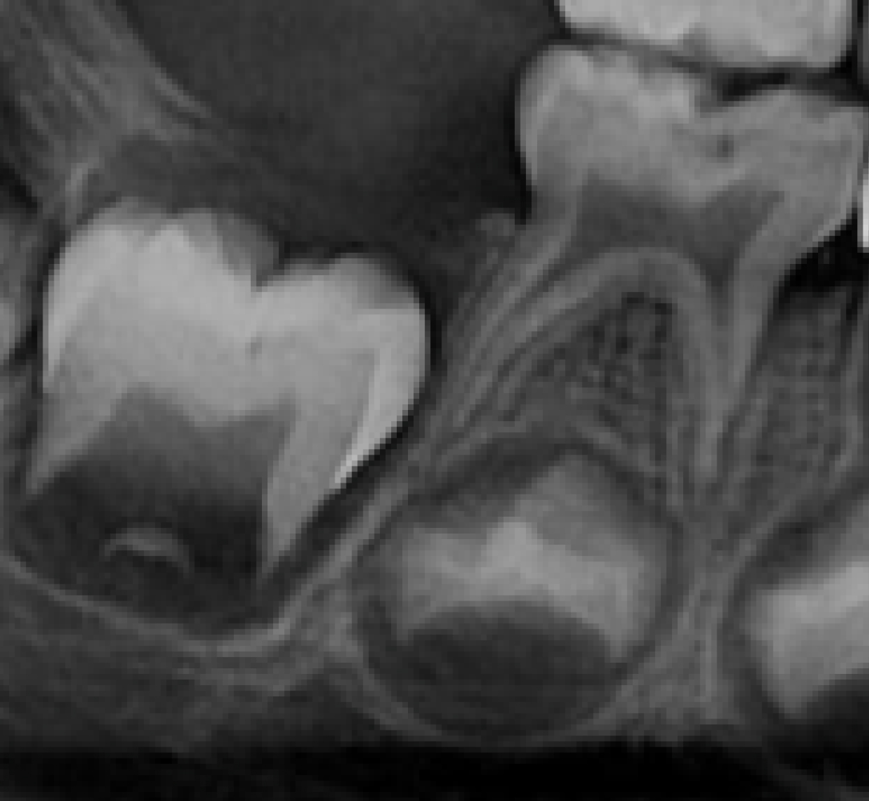 Journal of Clinical Pediatric Dentistry (JOCPD)