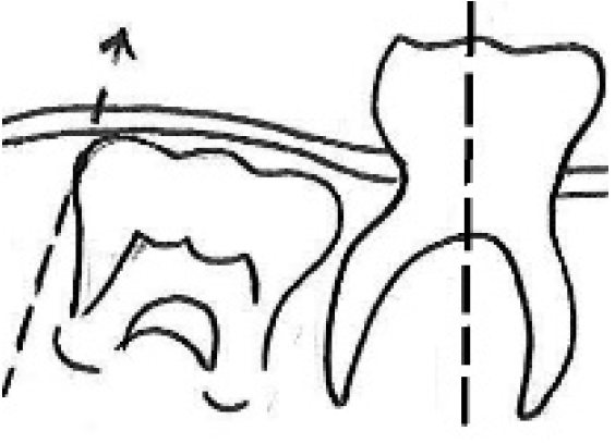 Journal of Clinical Pediatric Dentistry (JOCPD)