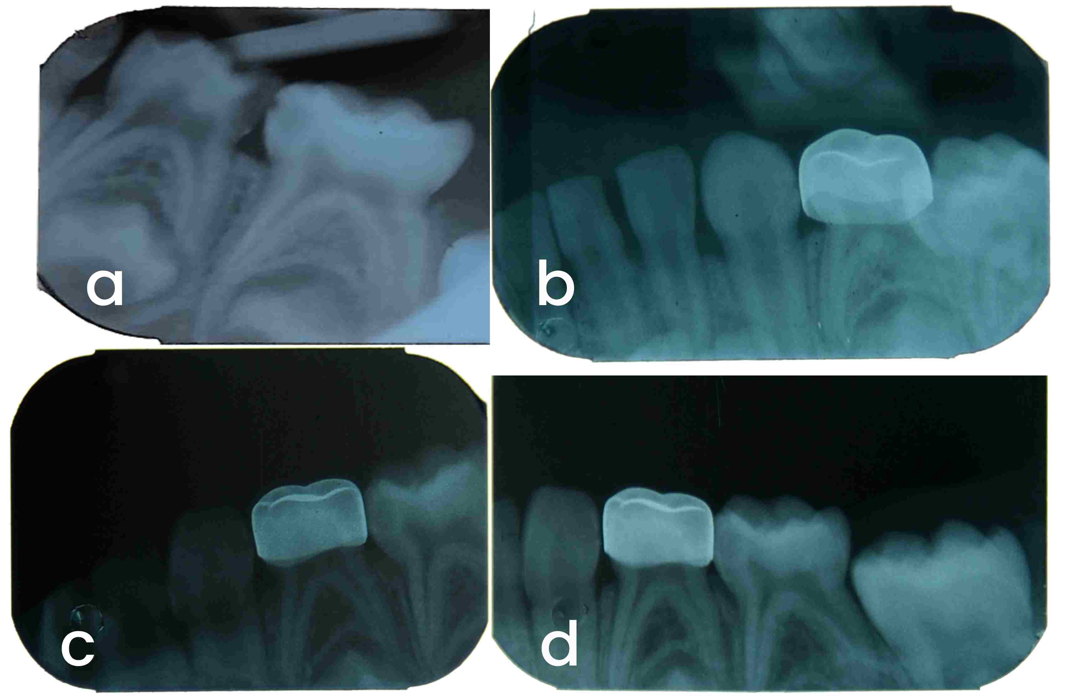 Journal of Clinical Pediatric Dentistry (JOCPD)