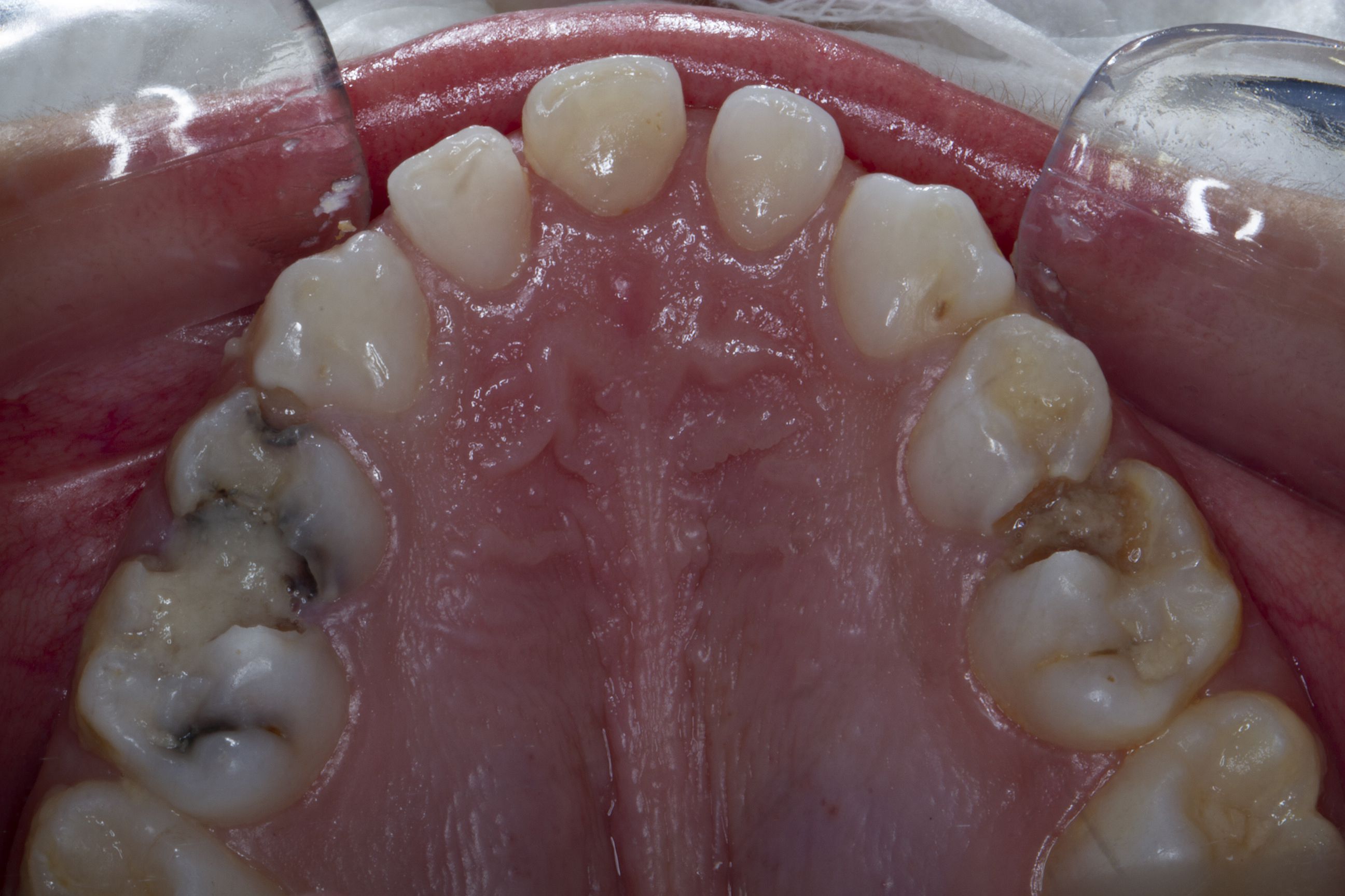 Journal of Clinical Pediatric Dentistry (JOCPD)