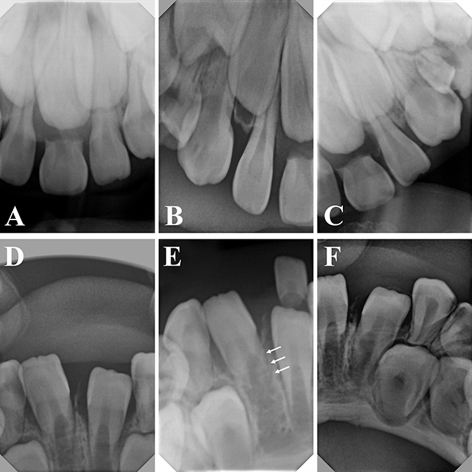 Journal of Clinical Pediatric Dentistry (JOCPD)