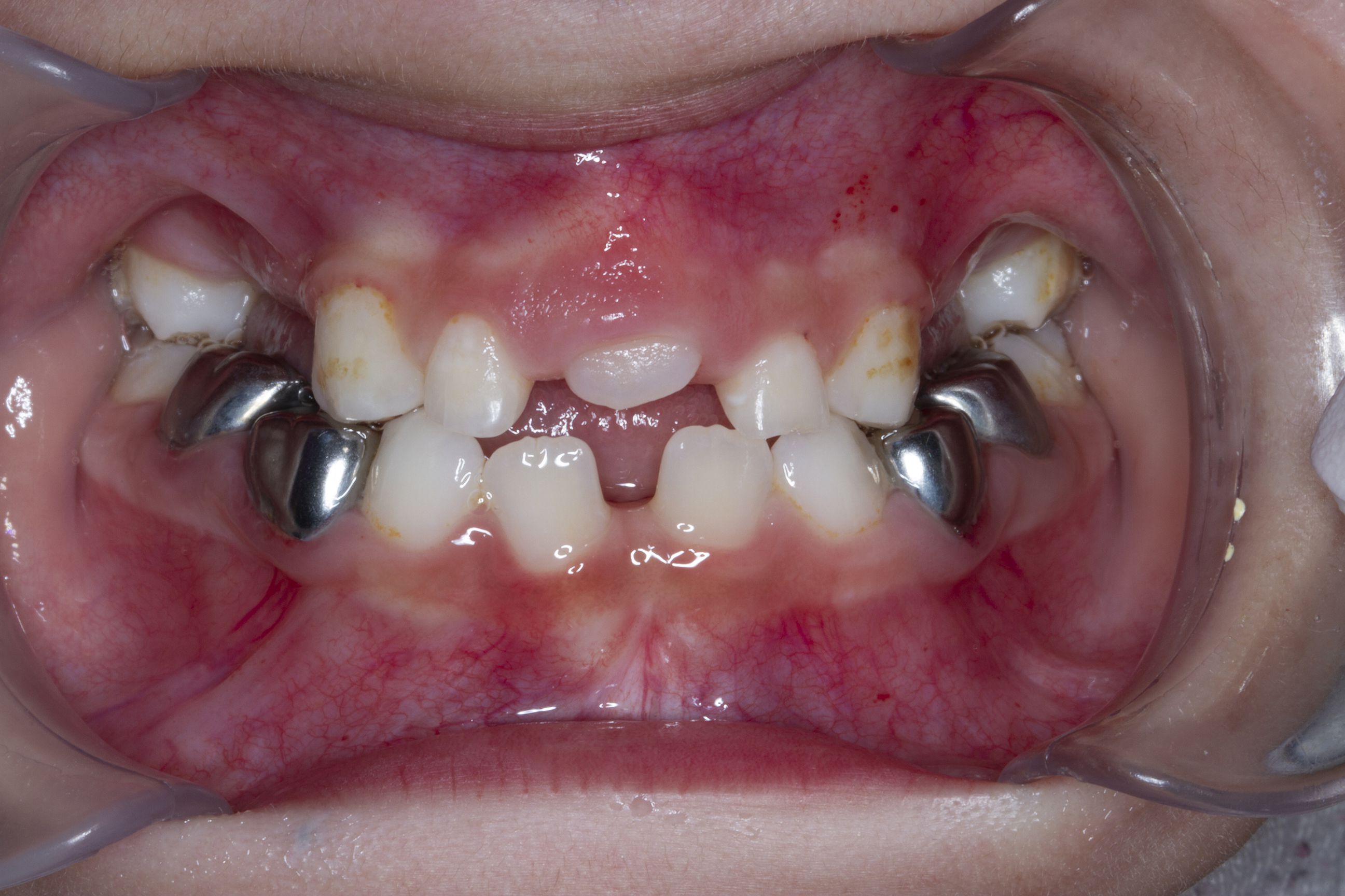 Journal of Clinical Pediatric Dentistry (JOCPD)