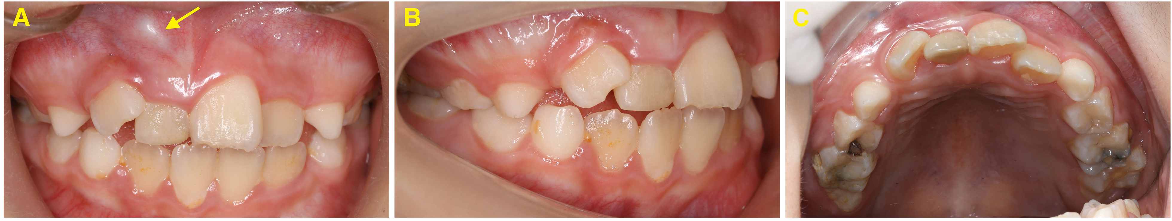 Journal of Clinical Pediatric Dentistry (JOCPD)