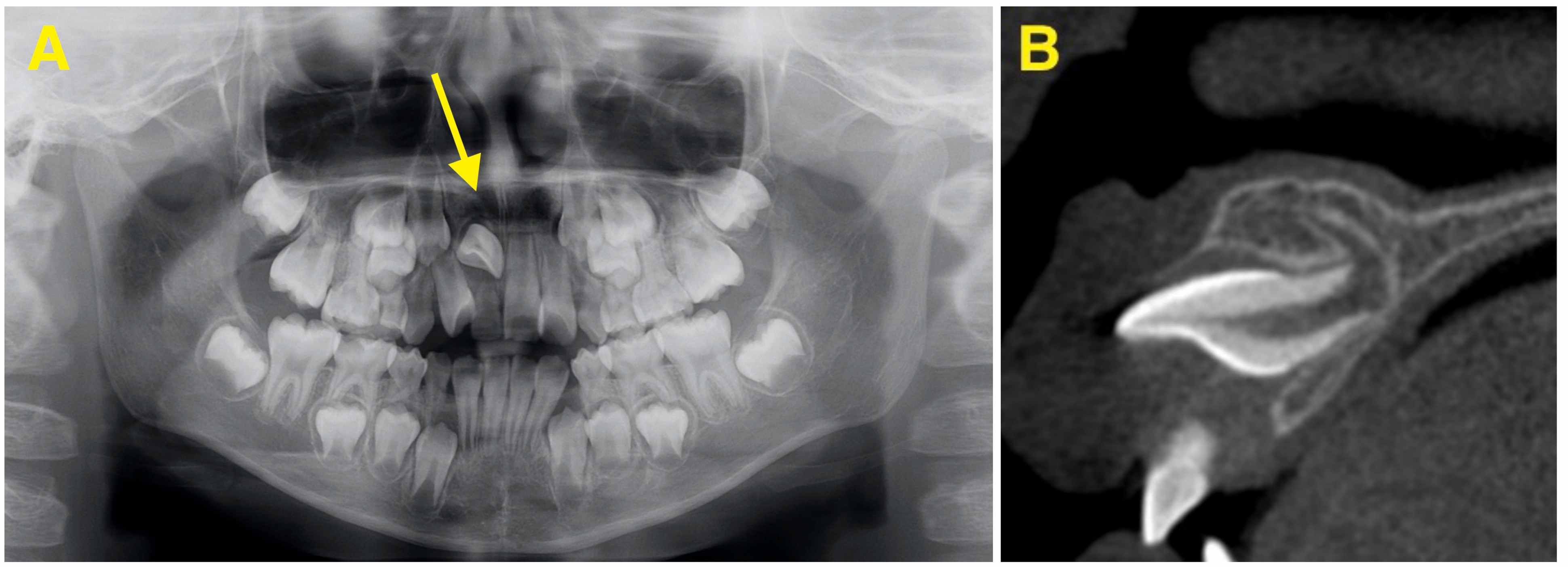 Journal of Clinical Pediatric Dentistry (JOCPD)