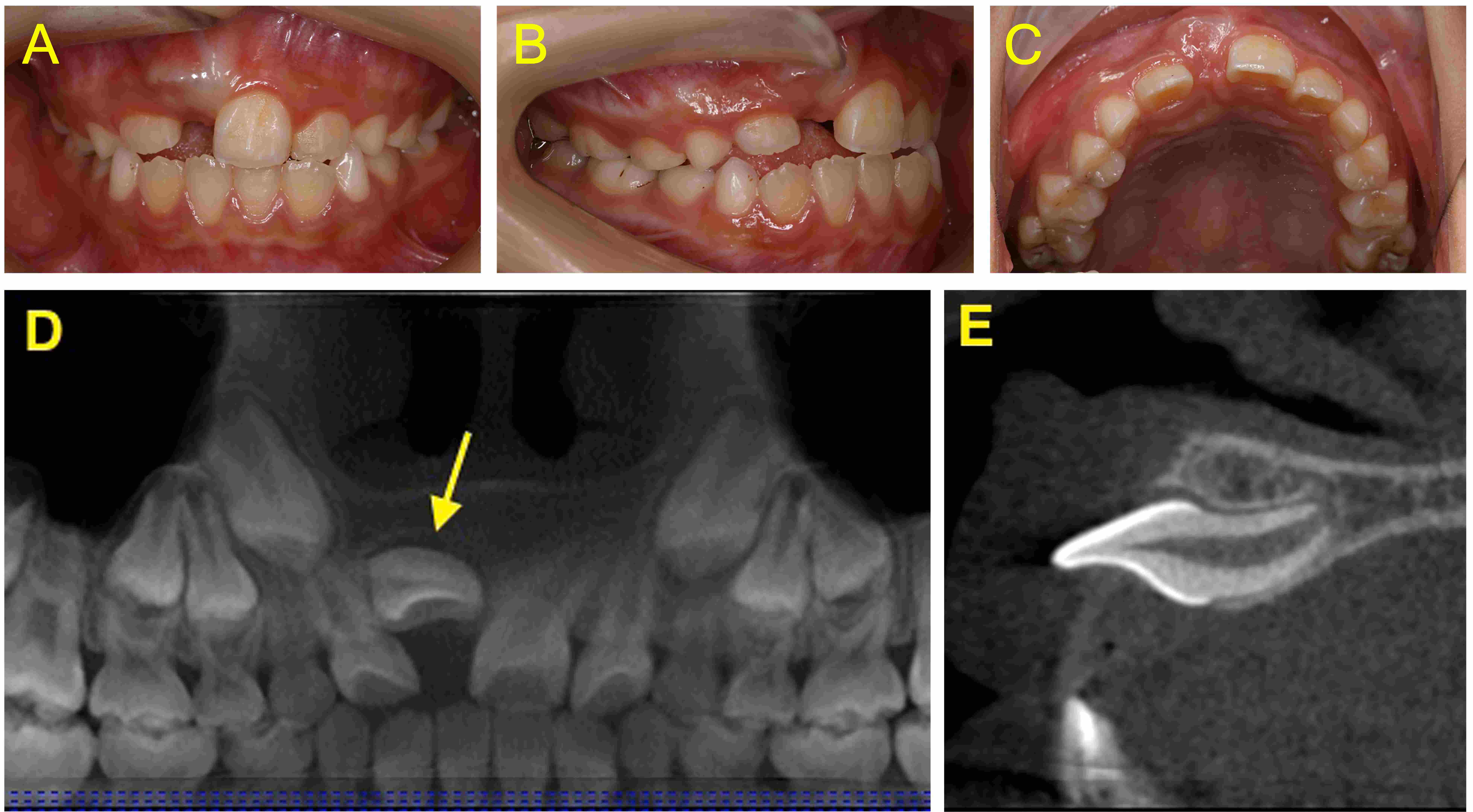 Journal of Clinical Pediatric Dentistry (JOCPD)