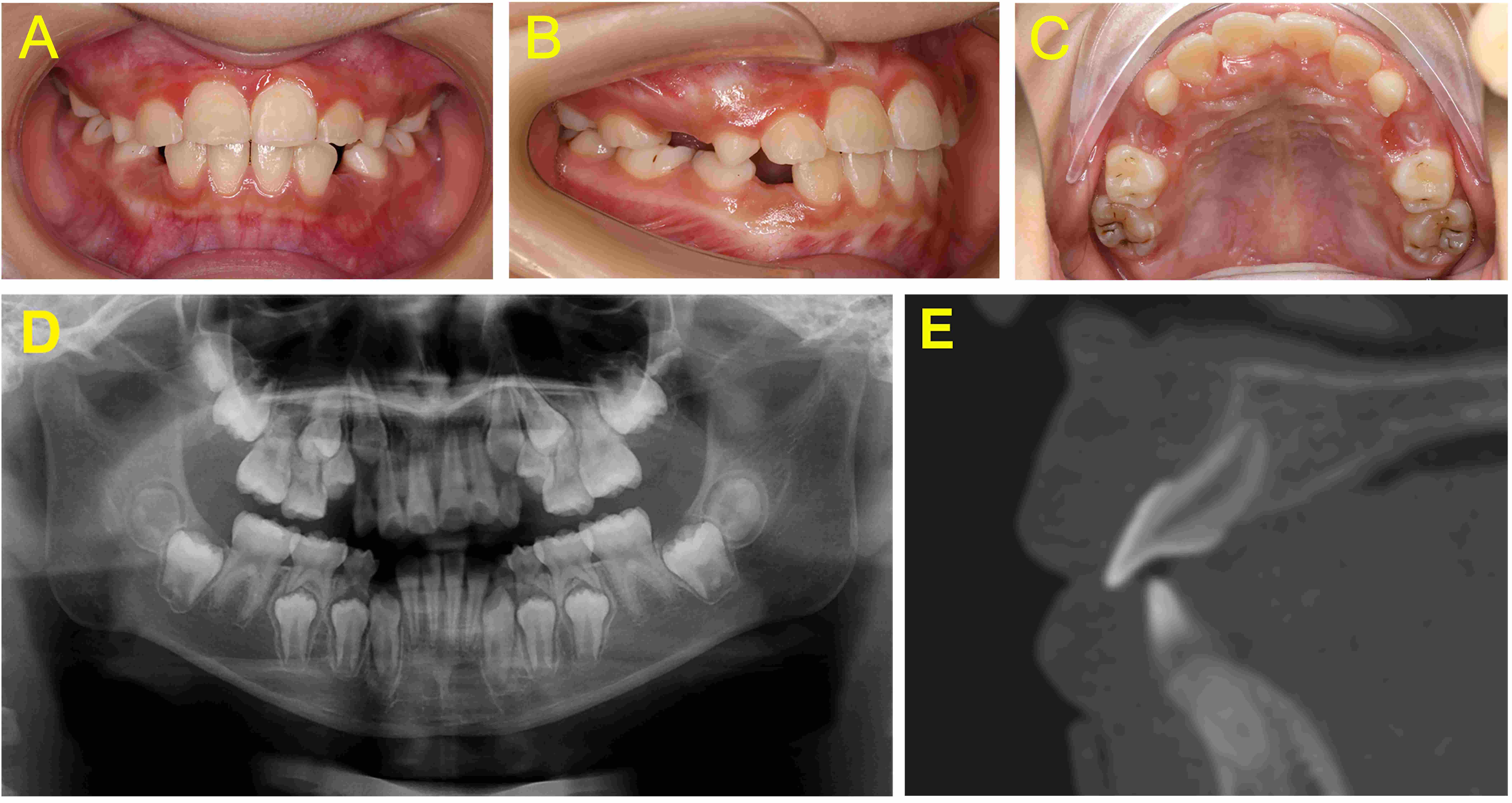 Journal of Clinical Pediatric Dentistry (JOCPD)