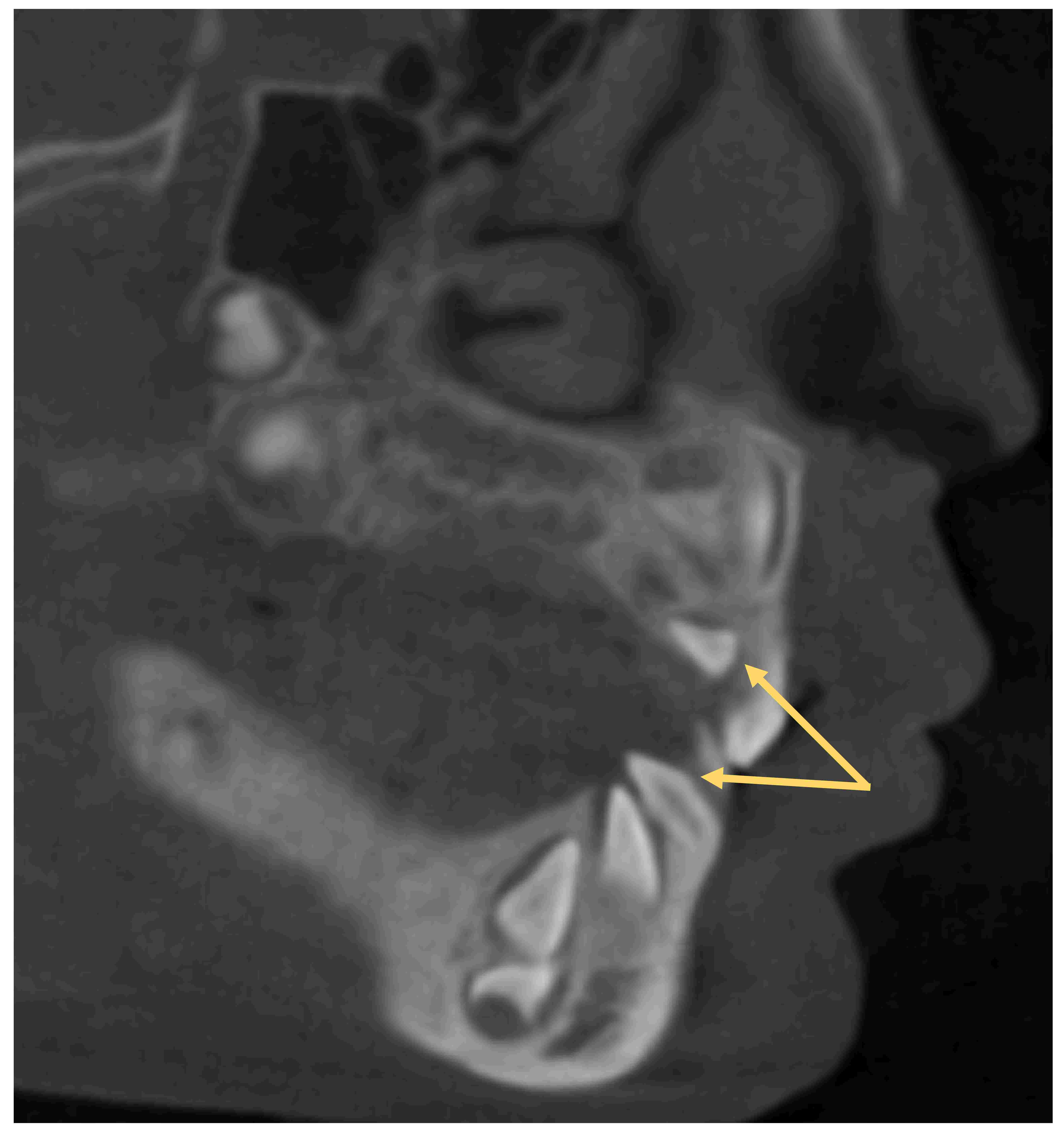 Journal of Clinical Pediatric Dentistry (JOCPD)