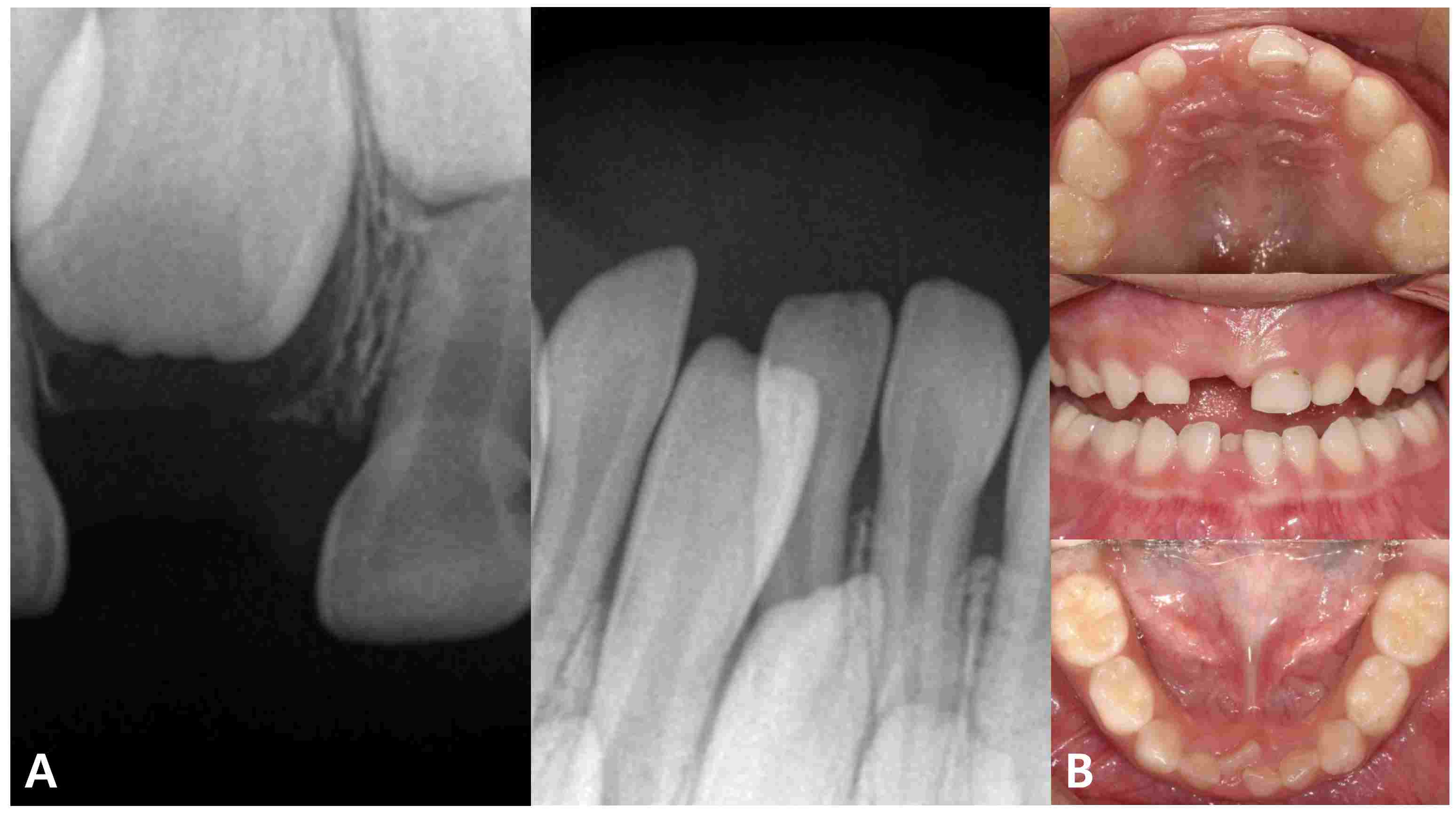 Journal of Clinical Pediatric Dentistry (JOCPD)