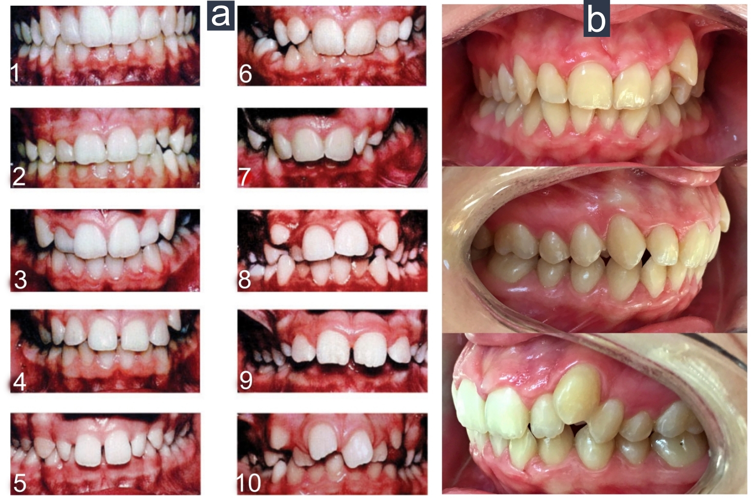 Journal of Clinical Pediatric Dentistry (JOCPD)