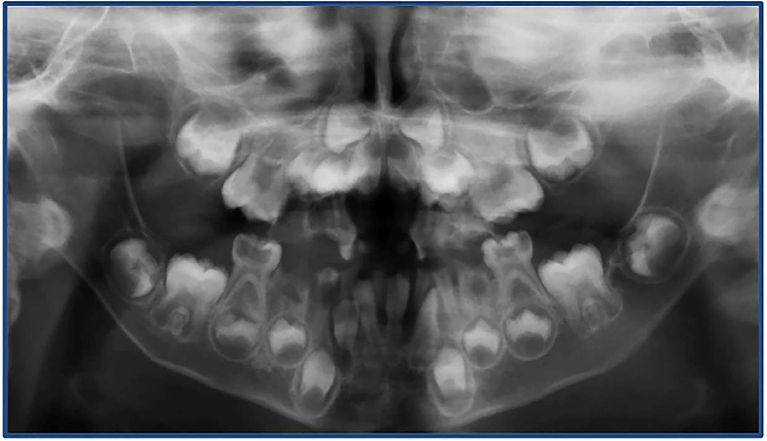 Journal of Clinical Pediatric Dentistry (JOCPD)