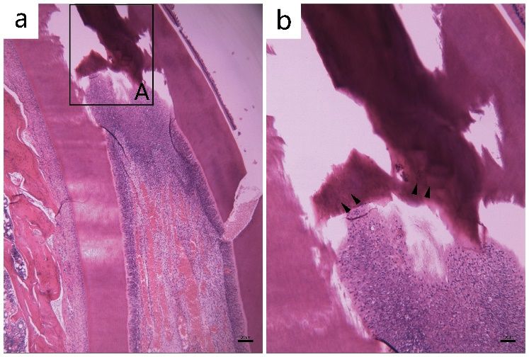 Journal of Clinical Pediatric Dentistry (JOCPD)