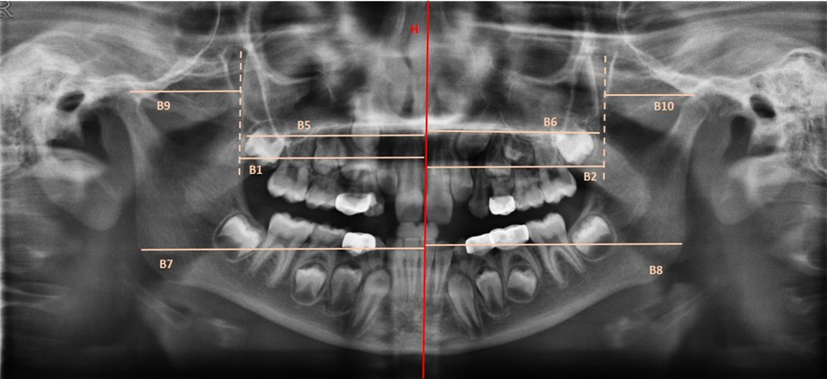Journal of Clinical Pediatric Dentistry (JOCPD)
