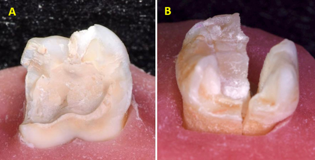 Journal of Clinical Pediatric Dentistry (JOCPD)