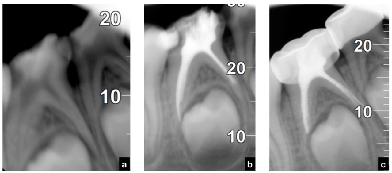 Journal of Clinical Pediatric Dentistry (JOCPD)