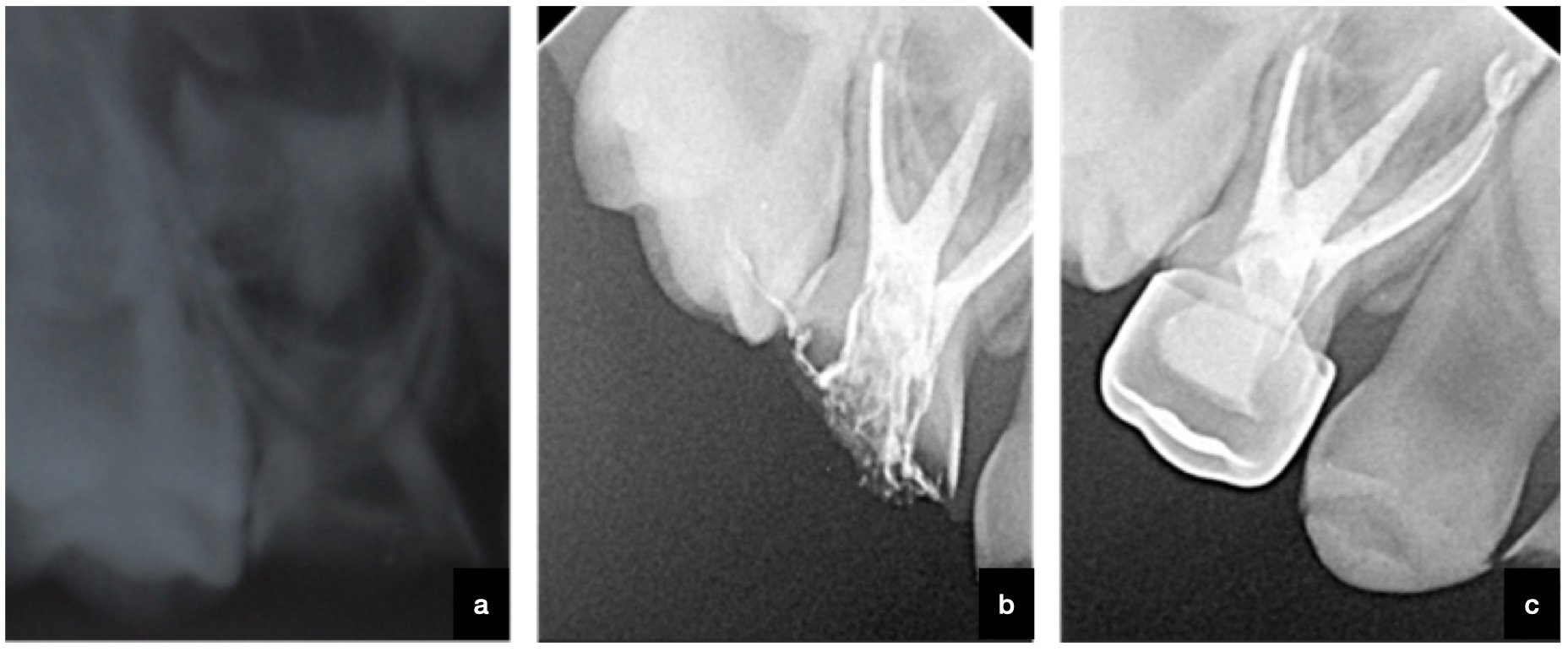 Journal of Clinical Pediatric Dentistry (JOCPD)