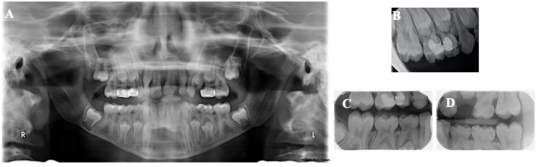 Journal of Clinical Pediatric Dentistry (JOCPD)