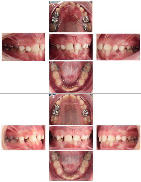 Journal of Clinical Pediatric Dentistry (JOCPD)
