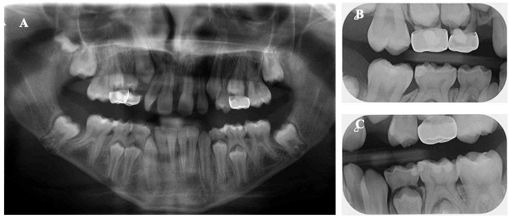 Journal of Clinical Pediatric Dentistry (JOCPD)