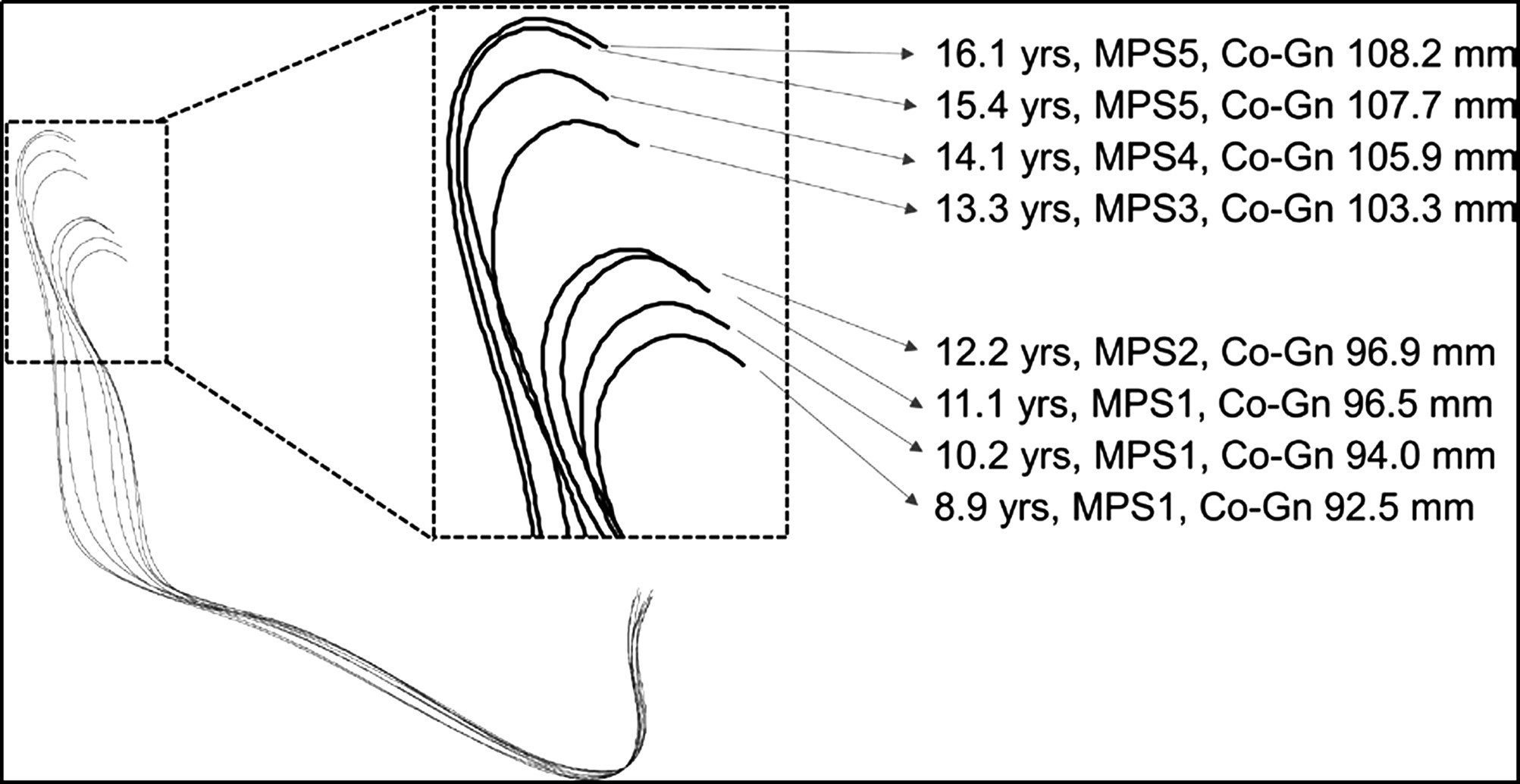 Journal of Clinical Pediatric Dentistry (JOCPD)