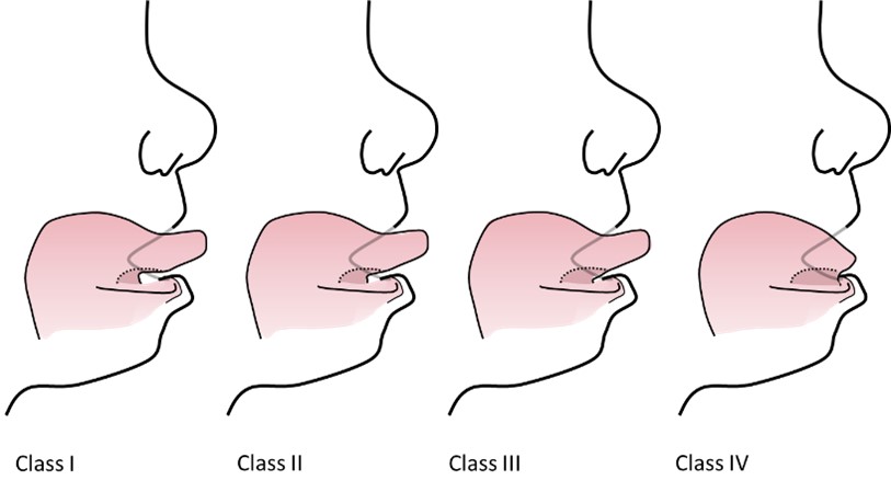 Journal of Clinical Pediatric Dentistry (JOCPD)