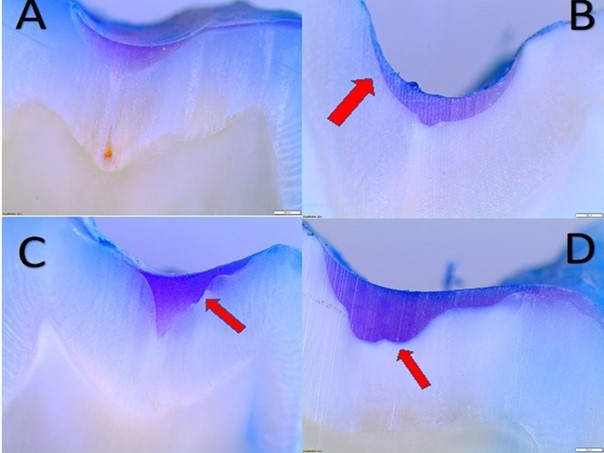 Journal of Clinical Pediatric Dentistry (JOCPD)