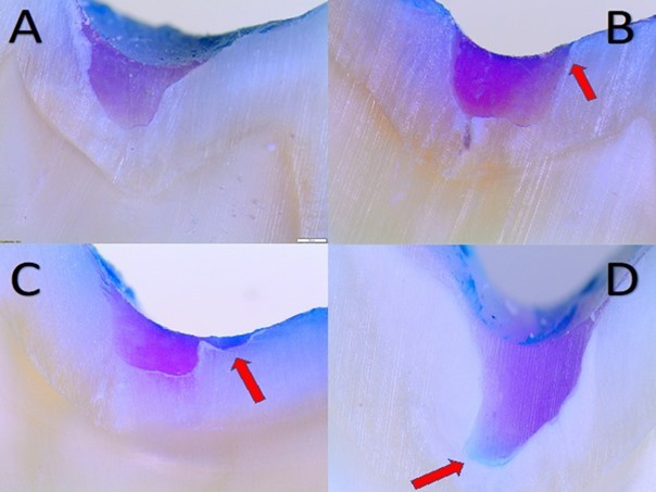 Journal of Clinical Pediatric Dentistry (JOCPD)